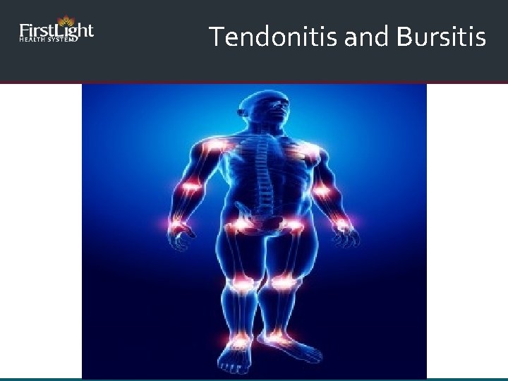 Tendonitis and Bursitis Thomas Mullin MD CAQSM Disclosure