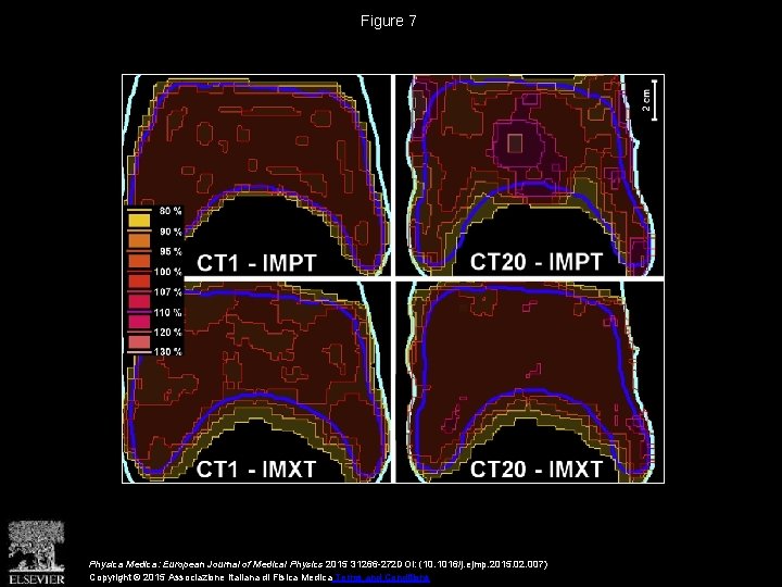 Impact of interfractional changes in head and neck