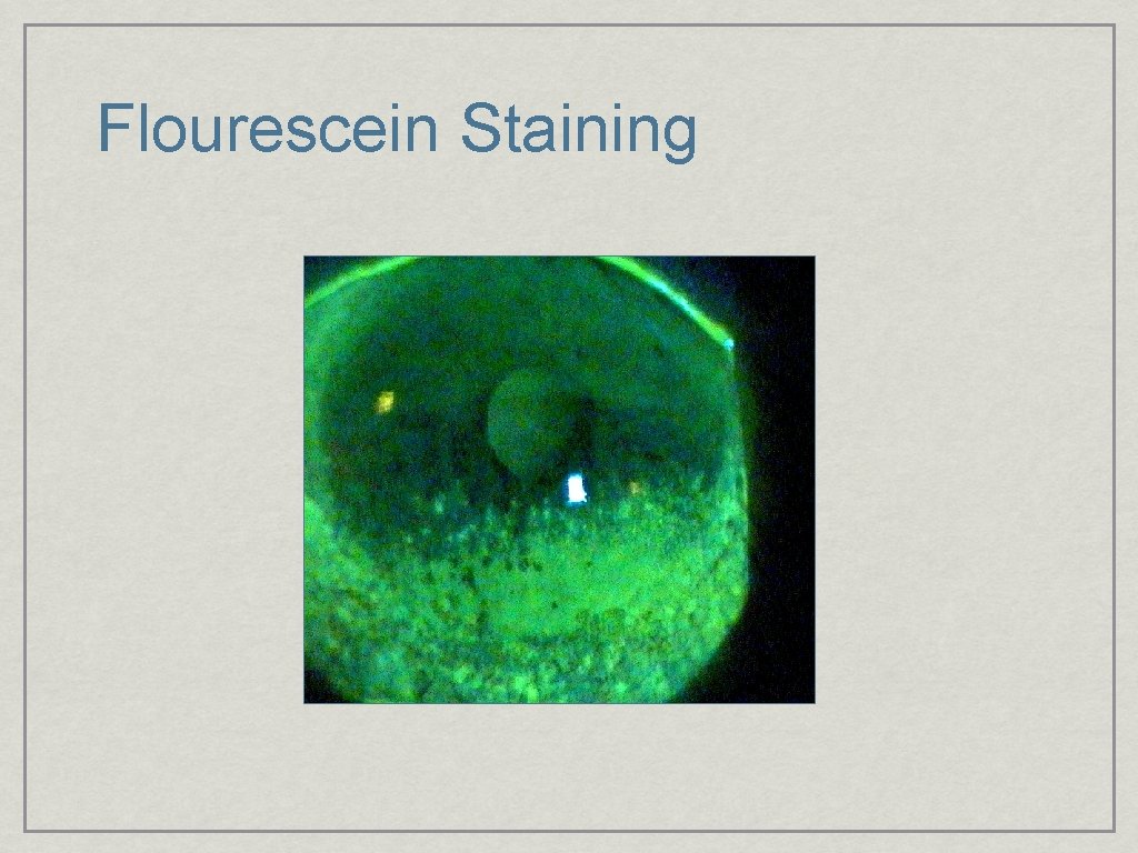 Trichiasis Conjunctiva Sclera Look at the bulbar the