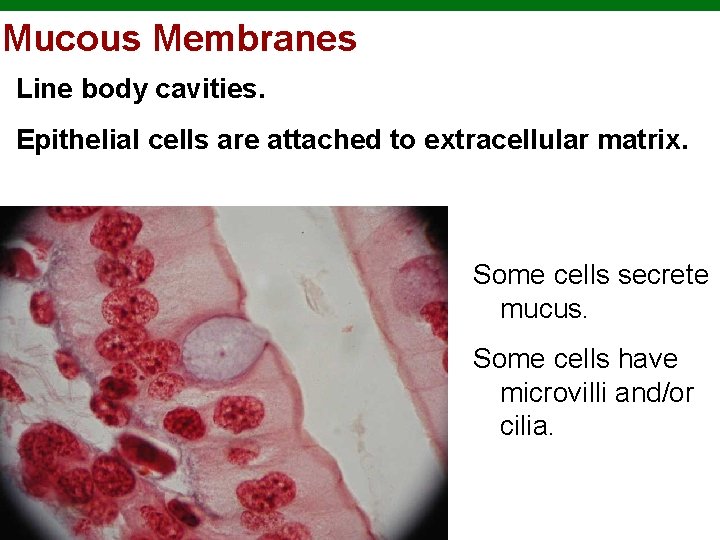 Chapter 21 Microbial Diseases of the Skin and