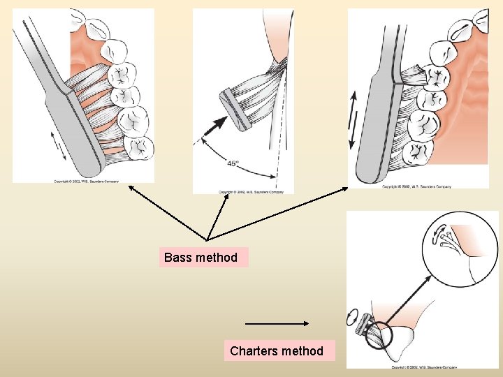 MECHANICAL PLAQUE CONTROL J E CBackground TMechanical plaque