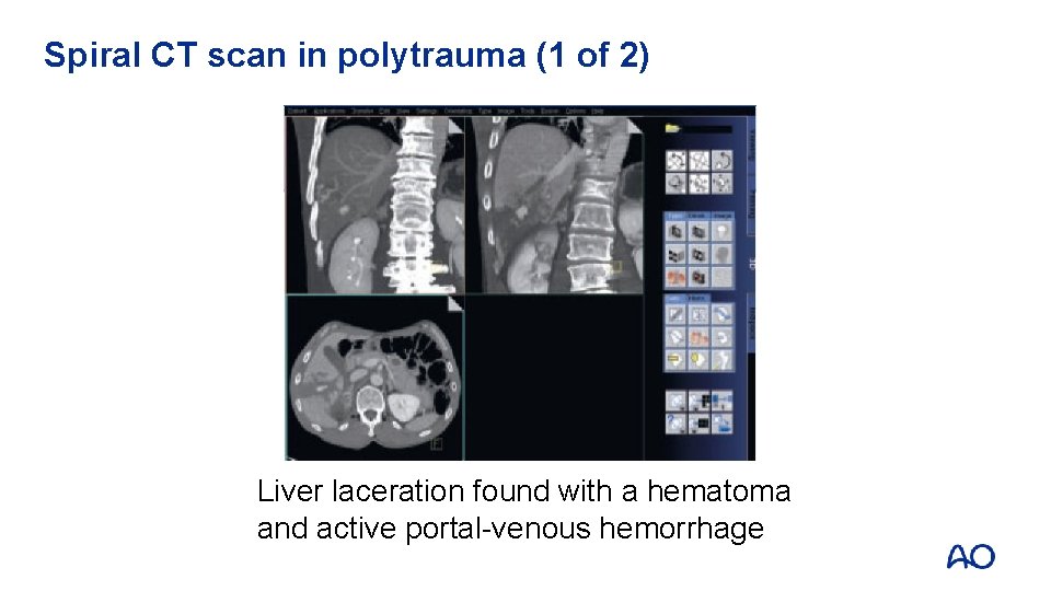 Imaging modalities in trauma surgery AO Trauma Basic