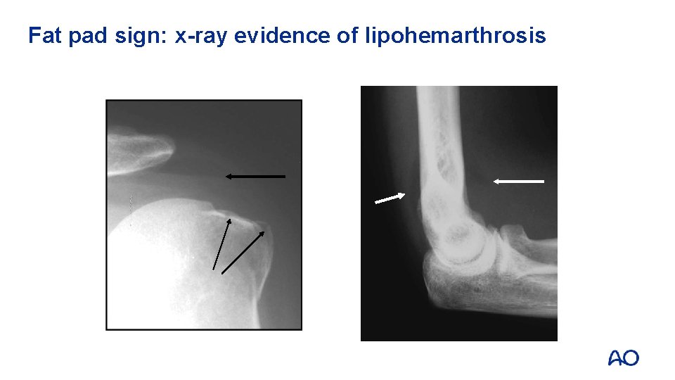 Imaging modalities in trauma surgery AO Trauma Basic