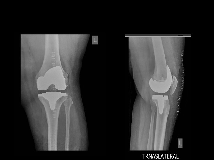 Case presentation Amro albeirutty PGY 4 63 yo