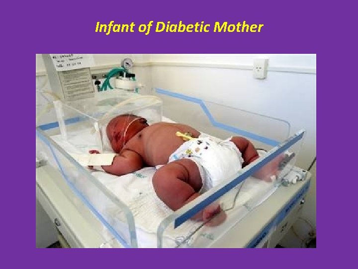 Infant of Diabetic Mother Diabetes Mellitus A chronic