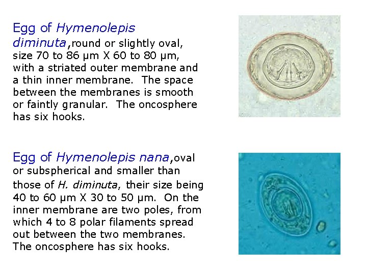 Hymenolepsis The Platyhelminthes Flatworms Tapeworms Hymenolepis nana The