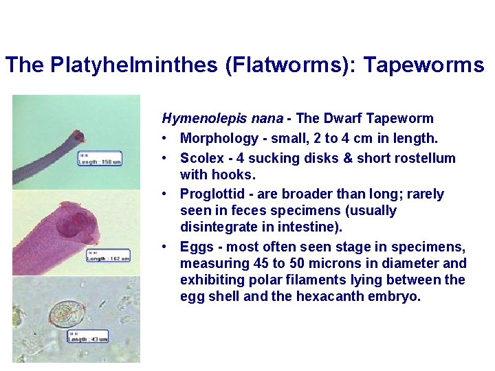 Hymenolepsis The Platyhelminthes Flatworms Tapeworms Hymenolepis nana The
