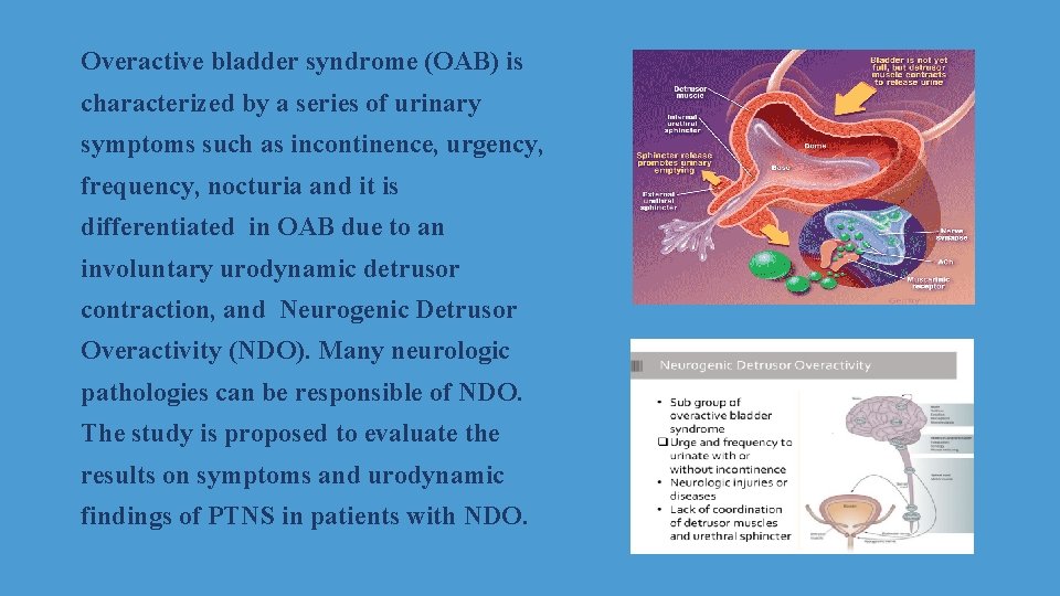ROLE OF PERCUTANEOUS TIBIAL NERVE STIMULATION PTNS IN
