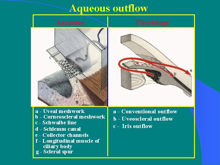 GLAUCOMA DR KHALID AL ZUBI ASSOCIATE PROFESSOR SPECIAL