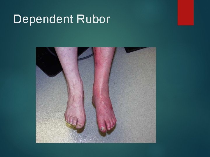 Diagnostic Medical Sonography Program Vascular Technology Holdorf LECTURES