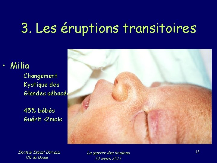 Les maladies boutons Ou Docteur Daniel Dervaux CH