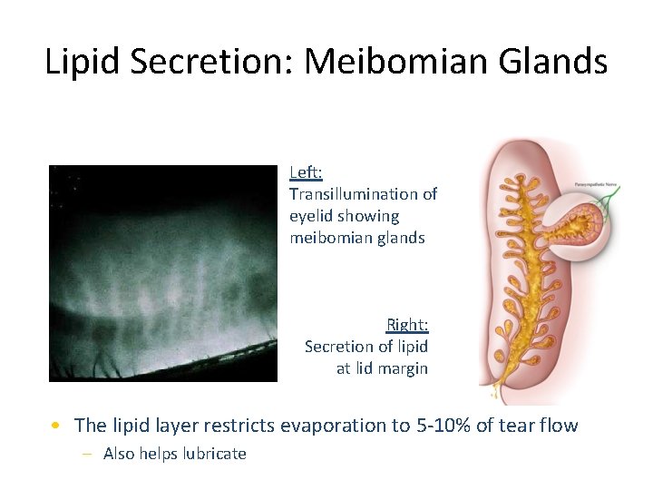 The Tear Evaluation Lynn E Lawrence CPOT ABOC