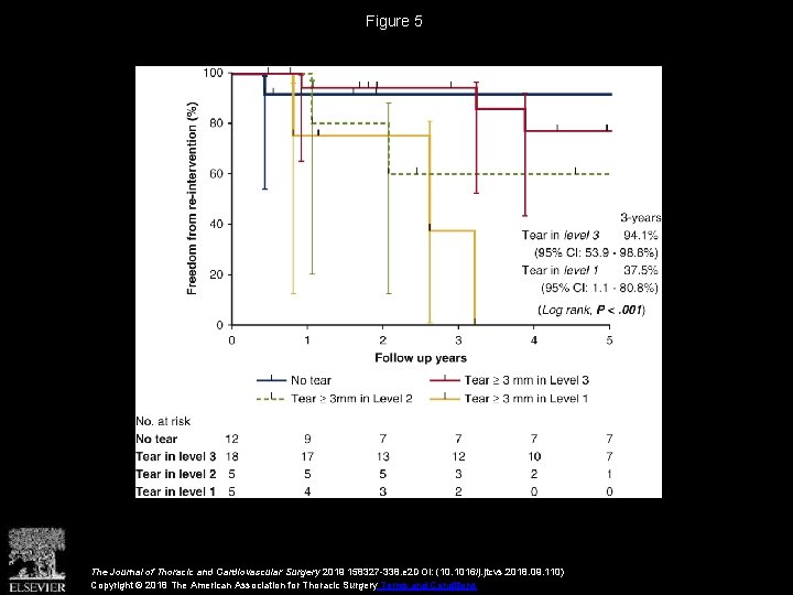 Differential impact of intimal tear location on aortic