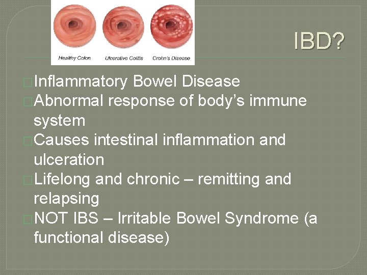All you need to know about STRESS Megan