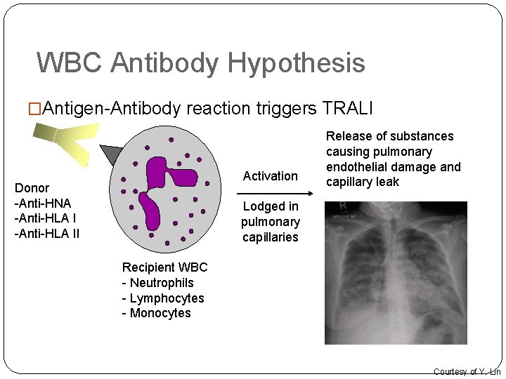 TRANSFUSION RELATED ACUTE LUNG INJURYTRALI BY DR PARESH
