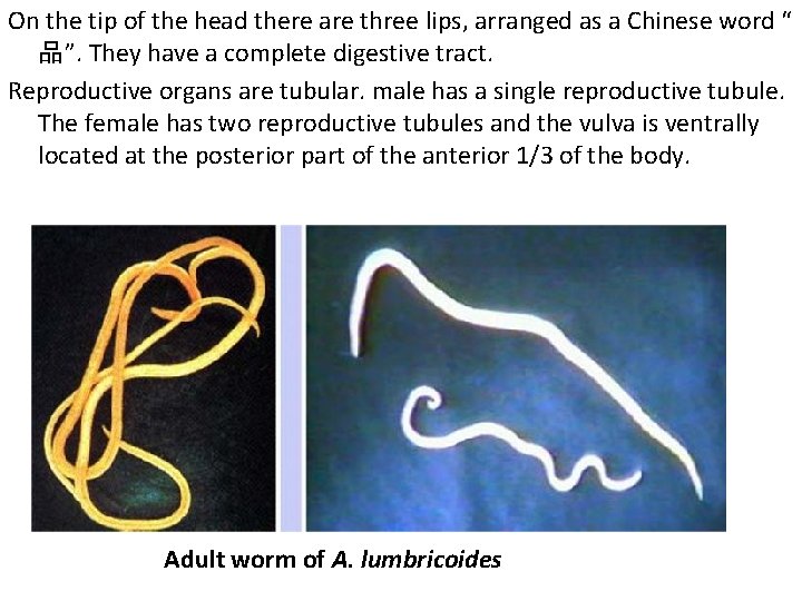 Ascaridoidea Practical parasitology Prof Dr Muna M Jori