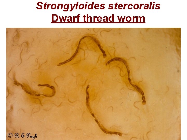 Family Rhabditidae Strongyloides stercoralis Dwarf thread worm ...
