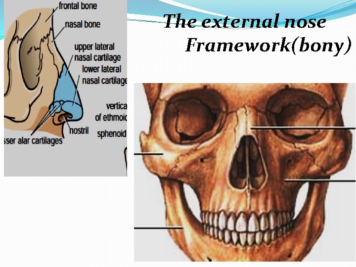 Nose and paranasal sinuses By Dr Adel Sahib