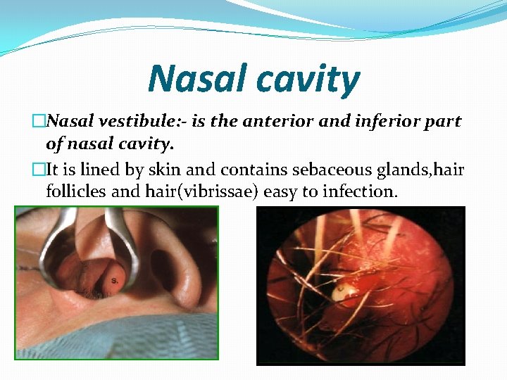Nose and paranasal sinuses By Dr Adel Sahib