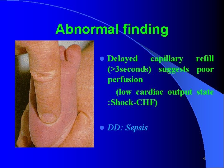 Neonatal cardiac disorders 1 2 3 Abnormal finding