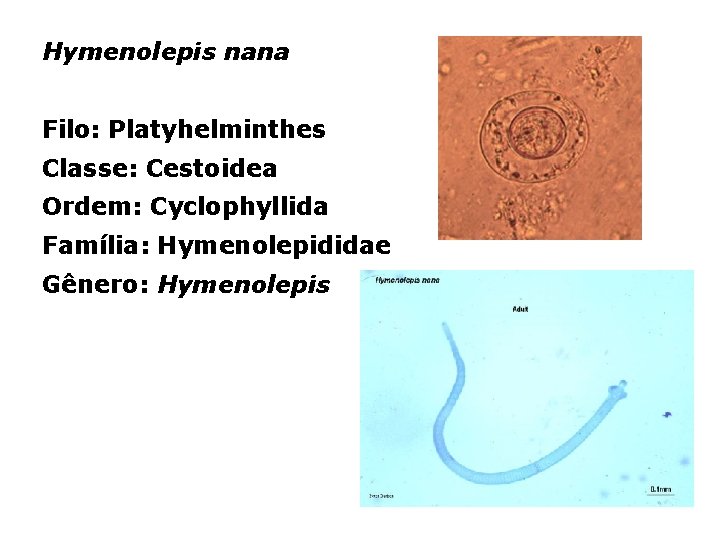 Hymenolepis nana Filo Platyhelminthes Classe Cestoidea Ordem Cyclophyllida