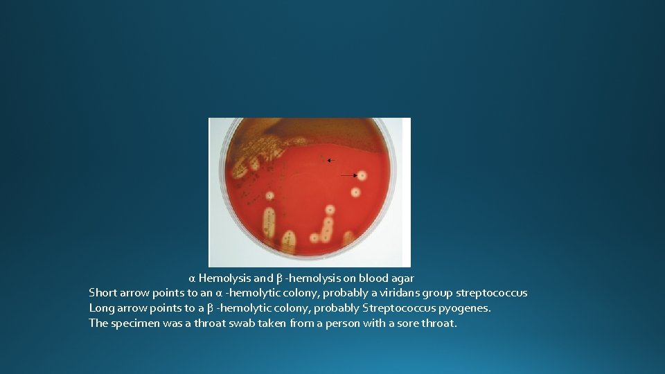 STREPTOCOCCUS Species Lancefield Group Typical Hemolysis Diagnostic ...