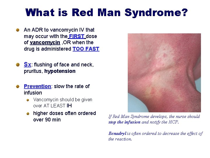 Antibiotics Part II Introduction to Antibiotics Part II
