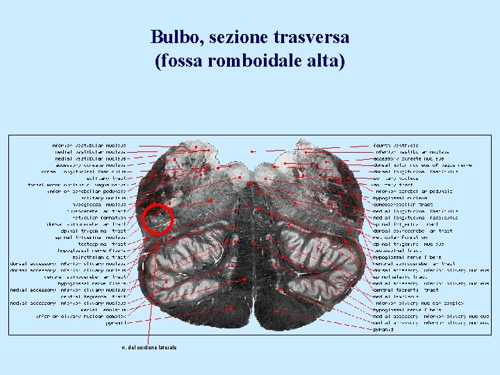 Tronco encefalico Tronco encefalico vista ventrale Tronco encefalico