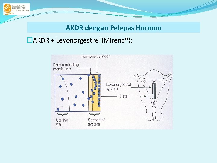 5 Kontrasepsi Hormonal b Injeksi Depo Kontrasepsi Hormonal