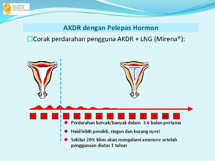 5 Kontrasepsi Hormonal b Injeksi Depo Kontrasepsi Hormonal
