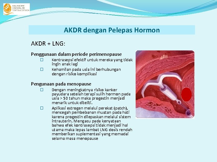 5 Kontrasepsi Hormonal b Injeksi Depo Kontrasepsi Hormonal