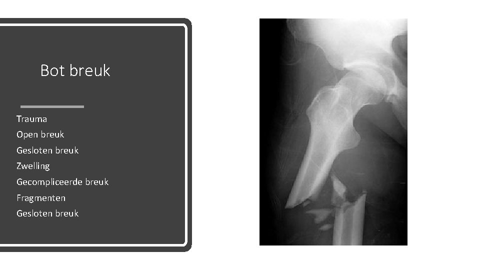 Ziekteleer Botten Gewrichten en Spieren Heupdysplasie Grotere honden