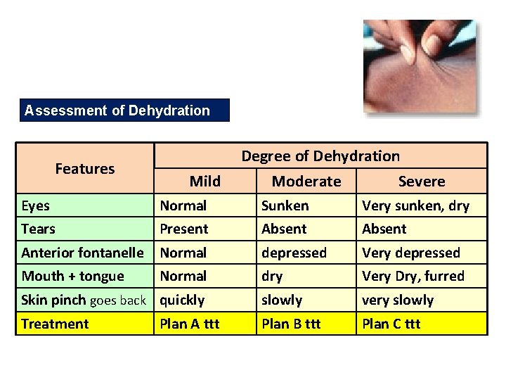 Epidemiology of Communicable Diseases Childhood Diarrhea ...
