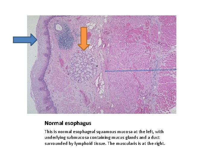 GI lab 1 esophagus and stomach Normal esophagus