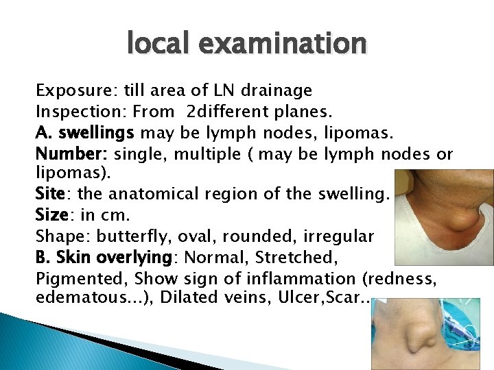 Clinical examination of superficial swelling By Esam El
