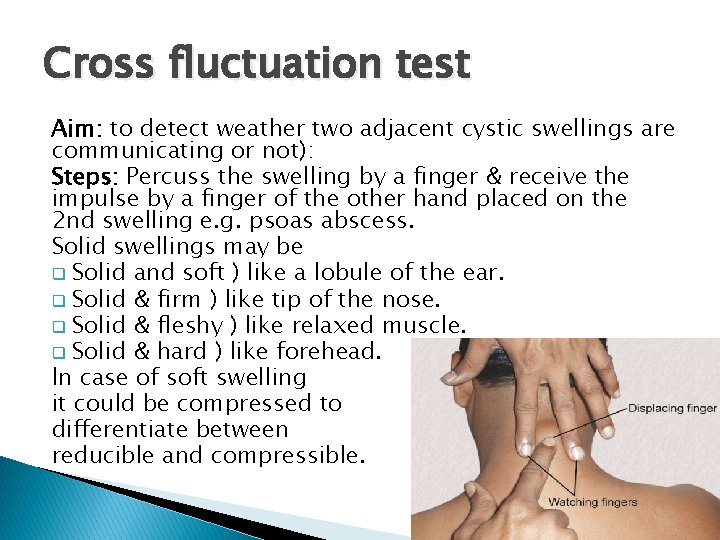Clinical examination of superficial swelling By Esam El