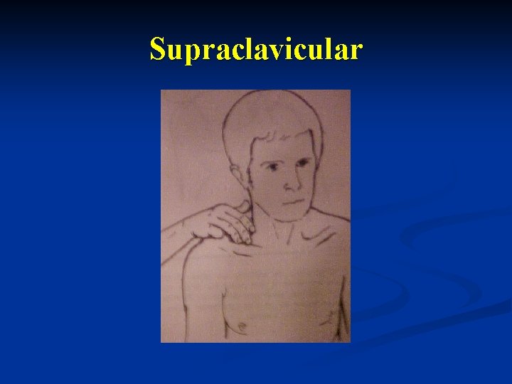 Examen de los ganglios linfticos Sistema Linfoganglionar COMPONENTES