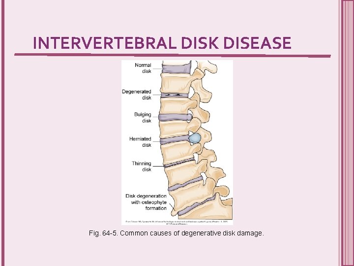 MUSCULOSKELETAL PROBLEMS ARTHRITIS AND CONNECTIVE TISSUE DISEASES Part
