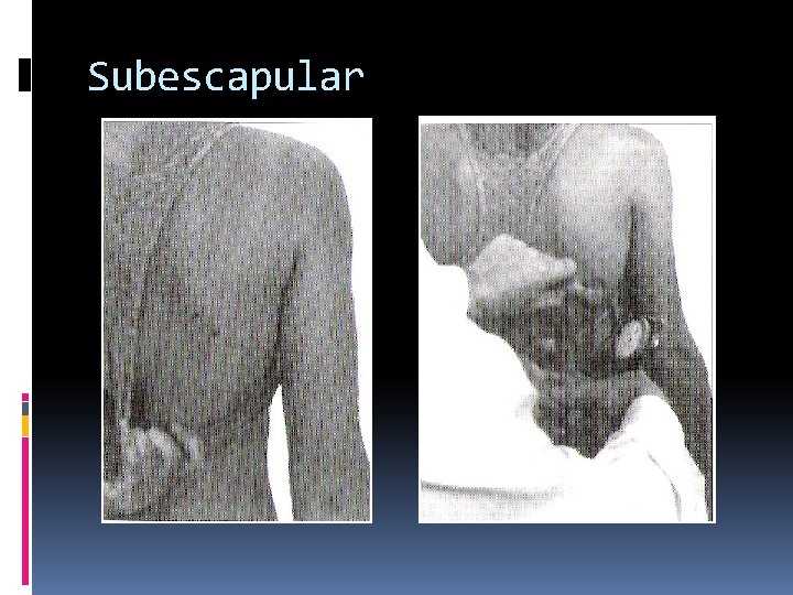 ANTROPOMETRA IMPORTANCIA DE LA ANATOMIA La anatoma es