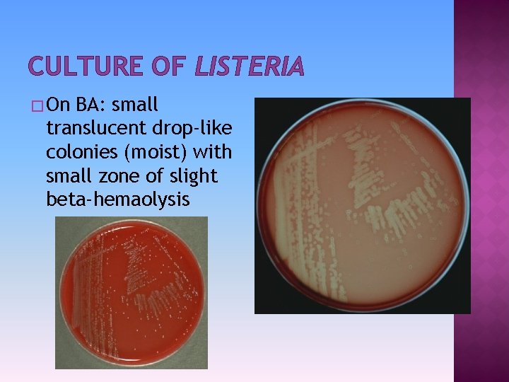LISTERIA MONOCYTOGENES Basmah almaarik Lab 7 LISTERIA SPP