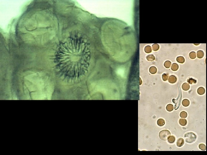 CESTODOSES LARVAIRES Cysticercose humaine Hydatidose Echinococcose ...