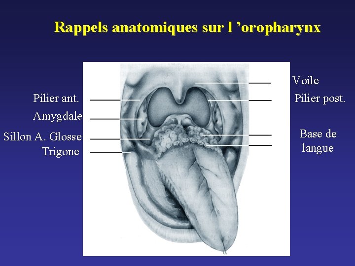 Les Angines tiologies Diagnostic volution Traitement IFSI 2007