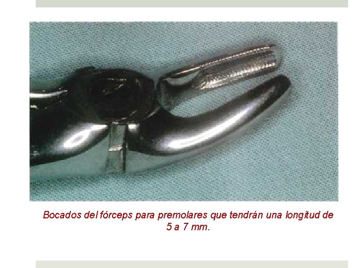 Tcnicas de Exodoncia en Maxilar y Mandbula SINDESMOTOMA