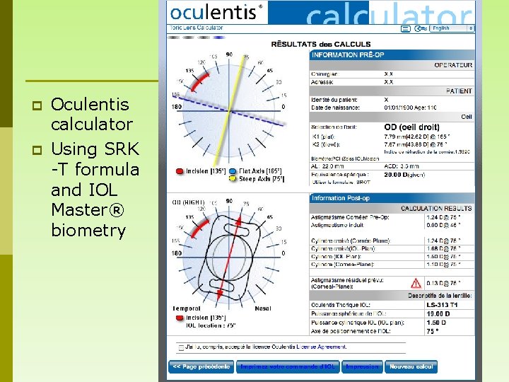 Visual and refractive outcomes following implantation of innovative