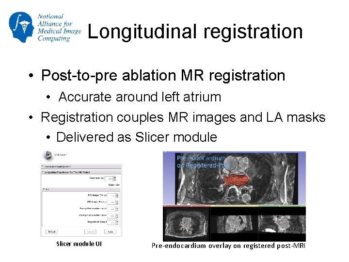 Algorithms UABBU Interactive segmentation feedback model Slicer ...