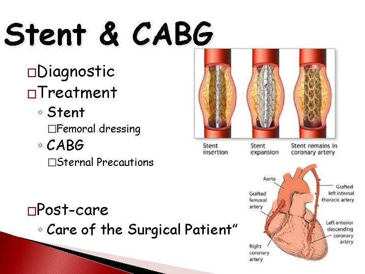 Cardiovascular System CNA 2 OSBN Curriculum Overview Anatomy