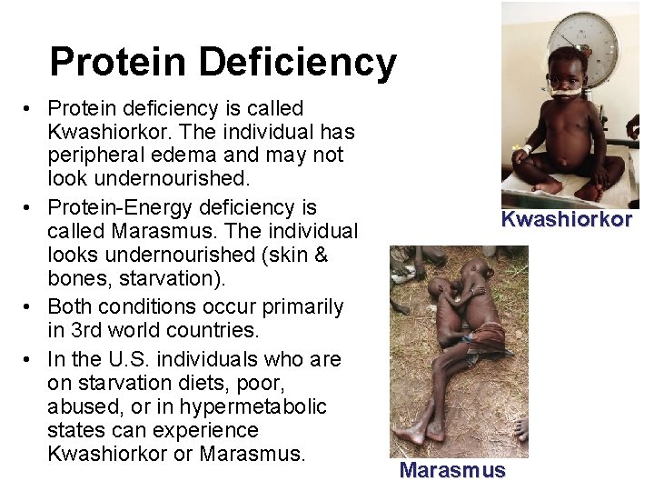Proteins From Foods to Cells in the Body