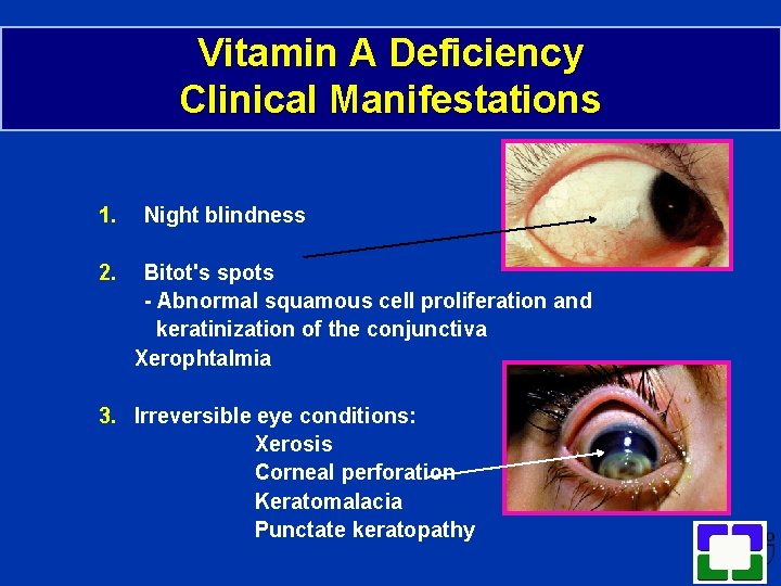 FatSoluble Vitamin Deficiencies Andrew Ukleja M D C