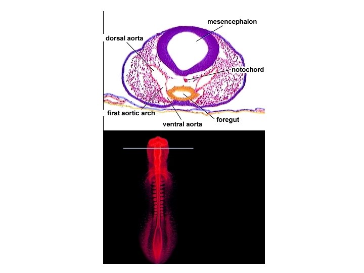 OUR AXIS anterior rostral dorsal posterior caudal ventral