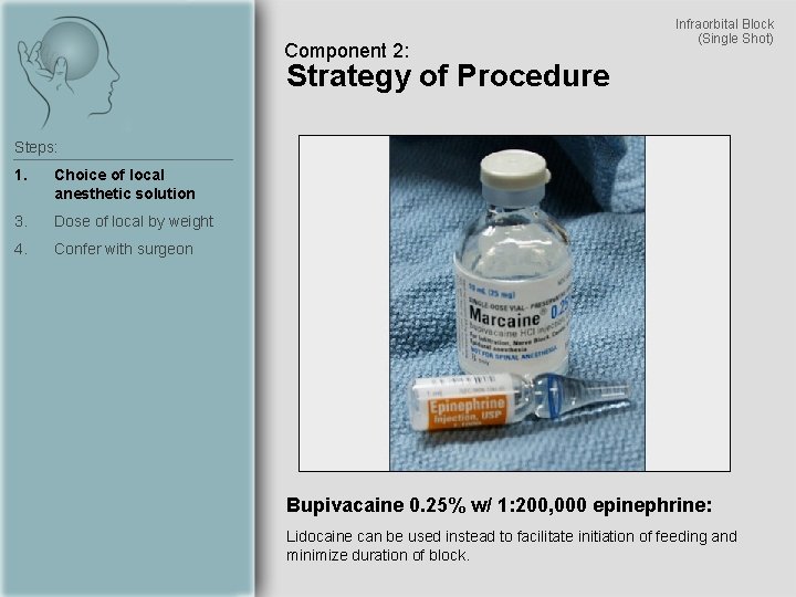 Infraorbital Nerve Block Santhanam Suresh MD FAAP Director